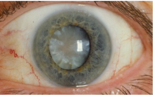 Development & Changes of the Nervous and Sensory Systems – A Primer for ...