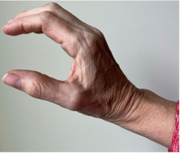 Upper Extremity & Ballistic Skills – A Primer for Understanding ...