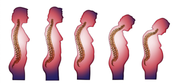 Posture and Balance – A Primer for Understanding Development Across The ...