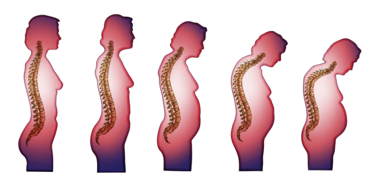 Posture and Balance – A Primer for Understanding Development Across The ...