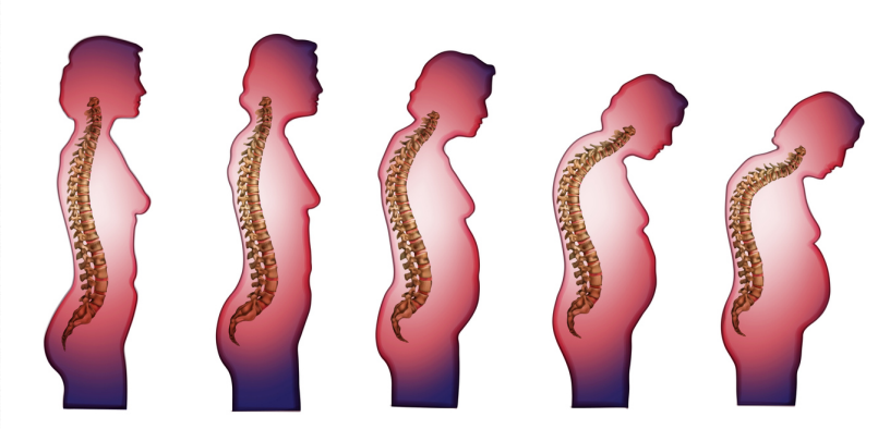 Posture and Balance – A Primer for Understanding Development Across The ...